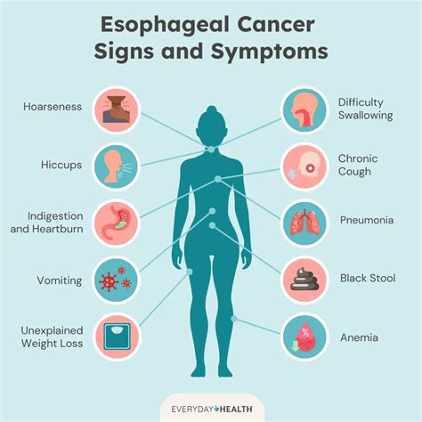 Esophageal Cancer Symptoms Causes Diagnosis Treatment And Prevention