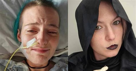 “현실판 뱀파이어” 마늘 먹으면 30번 구토… 美 30대 여성 무슨 사연