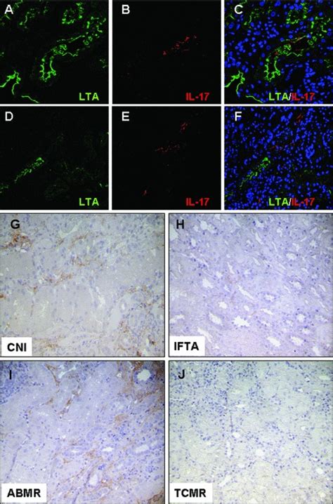 Tubular Characterization Of Il 17 And Analysis Of Il 6 Expression
