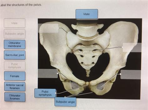 Solved Label The Structures Of The Pelvis Please Help