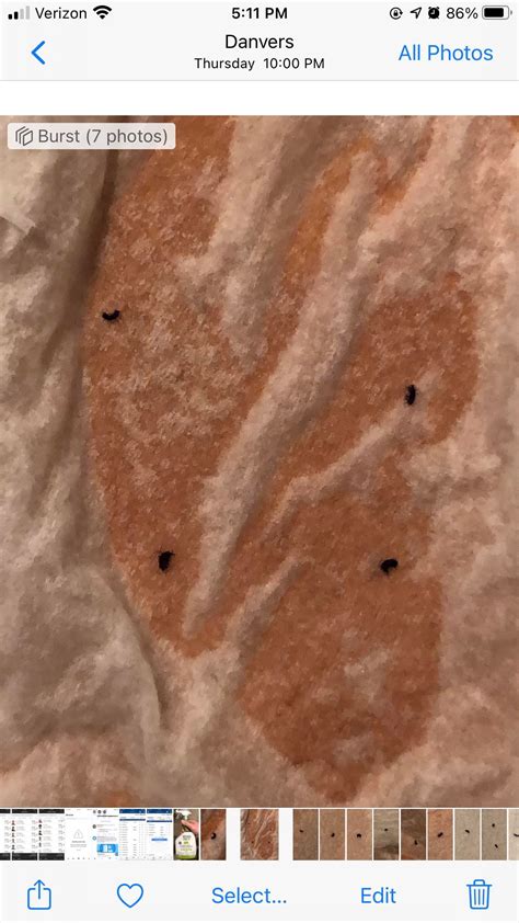 Help What Is Biting Me I Have These Tiny Black Bug Biting Me In The