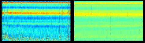 Simultaneous Eeg Fmri Fmri Artifact Detection And Removal