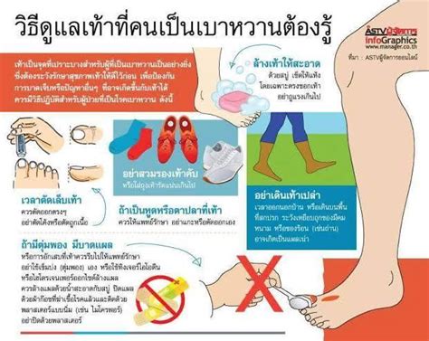 บ้านหมอใจดี อาการชาปลายมือปลายเท้า ในผู้ที่เป็นเบาหวาน Facebook