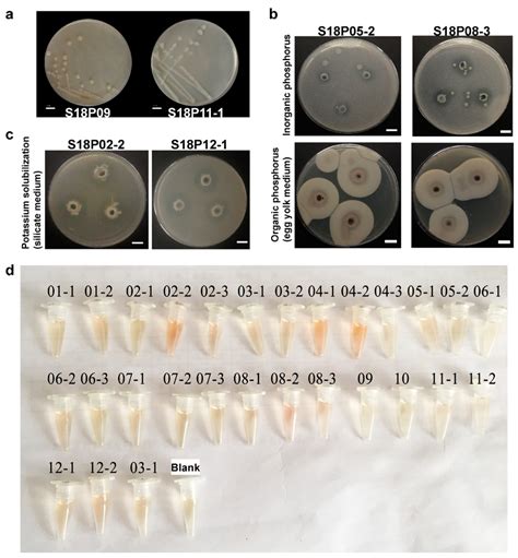 Isolation Of Nitrogen Fixing Bacteria Nfb From Pea Embryos And Their