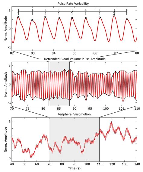 Bcia Essential Skills Blood Volume Pulse