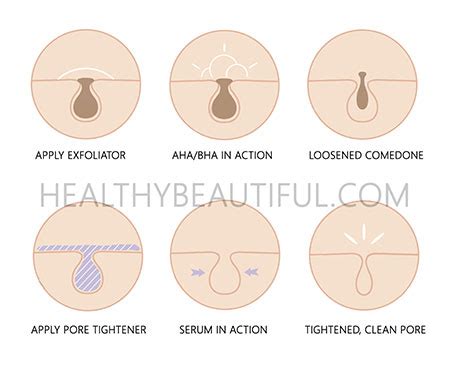 Top 6 Steps To Unclog Your Pores Refine Your Skin Healthy Beautiful