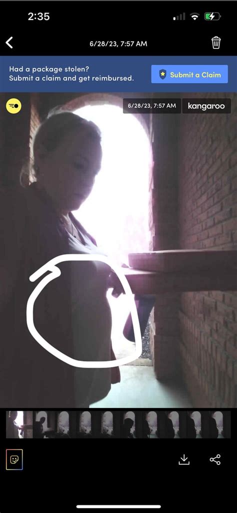 Has Anyone Tried An Iud To Deal With Fibroid Symptoms R Fibroids