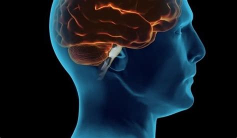 Неврохирург Заболяванията на хипофизата трябва да се лекуват навреме