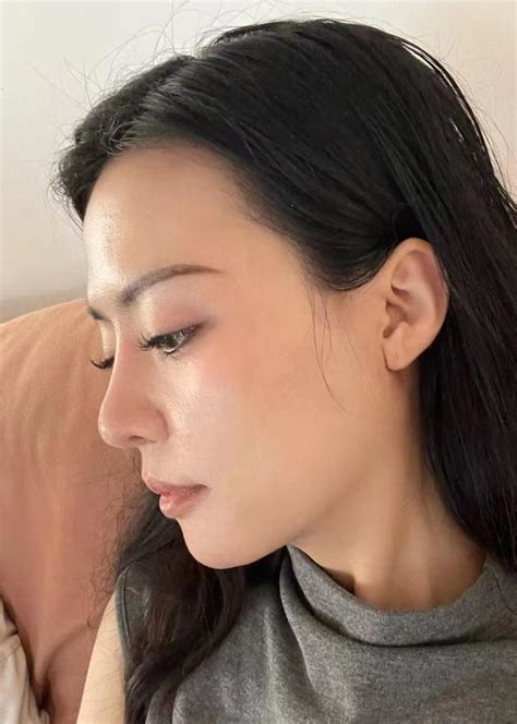广州下颌磨骨术后1个月恢复记录；方脸变v脸 知乎