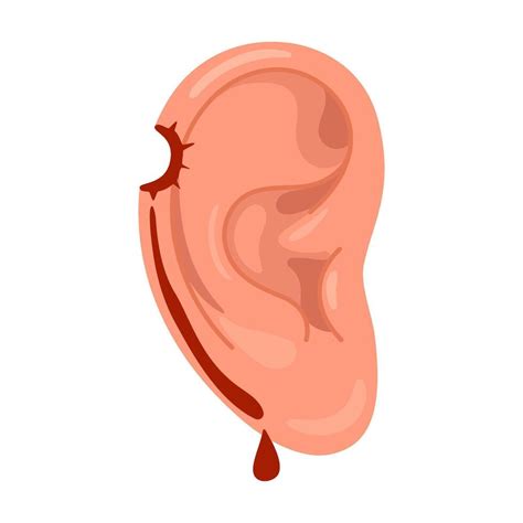 Bleeding From Ears Images Clipart