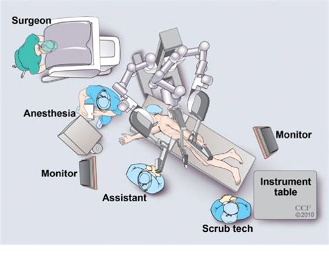 Figure 2 From Robot Assisted Laparoscopic Adrenalectomy Step By Step Technique And Comparative