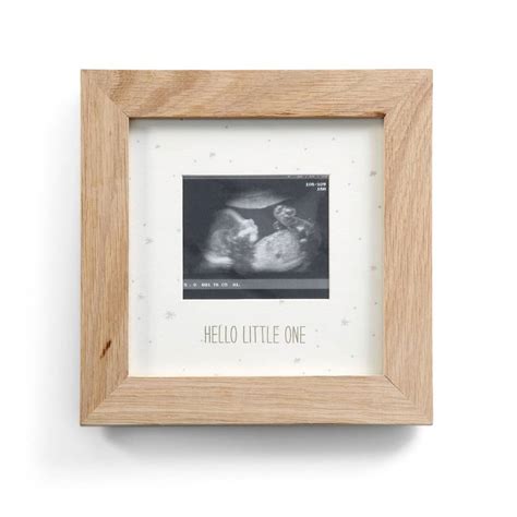 Everything You Need To Know About Your 12 Week Scan