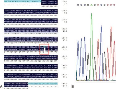 a sequence of the cds region in exon 9 of eif2ak4 b the c 1392delt