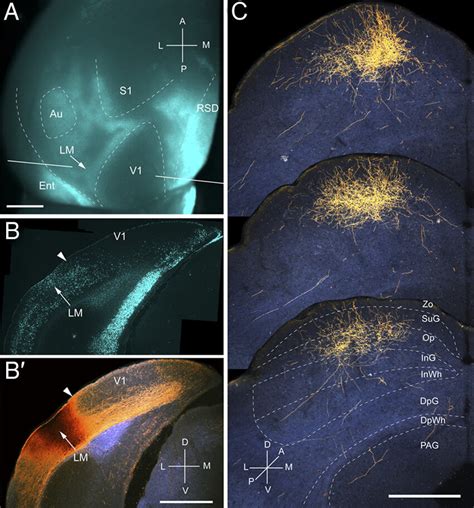 Projections Of Lm To The Sc A In Situ Image Of Callosal Connections Download Scientific