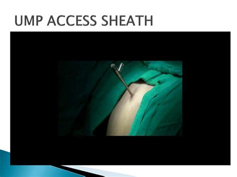 Ppt Ultra Mini Pcnl Ump Powerpoint Presentation Free Download Id3015334