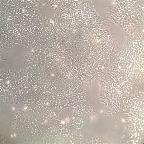 Have My Ipscs Differentiated Researchgate