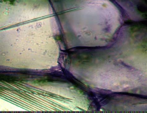 Raphide Crystal In 100ppm Hgcl 2 Treated Stem Download Scientific Diagram