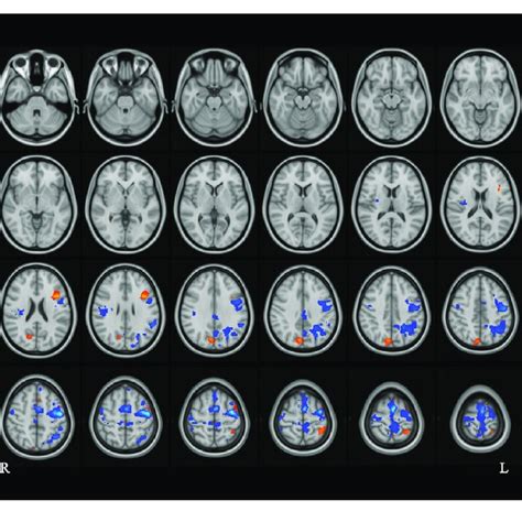 Main Effect Of Sex Across The Two Language Tasks The Areas Rendered Download Scientific