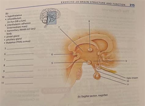 Solved 314 EXERCISE 20 BRAIN STRUCTURE AND FUNCTION D The Chegg Com