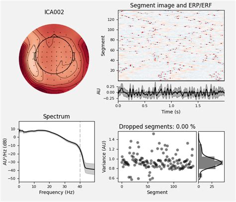 Overview Of Megeeg Analysis With Mne Python — Mne 0212 Documentation