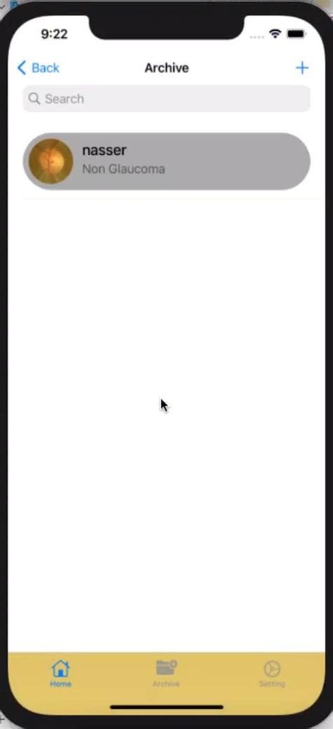 Github Abdelnasser100glaucoma Detection