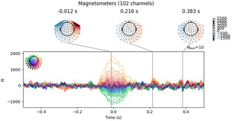 Overview Of Artifact Detection — Mne 1 6 1 Documentation