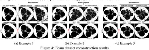 Figure 1 From A Self Supervised Approach To Reconstruction In Sparse X Ray Computed Tomography