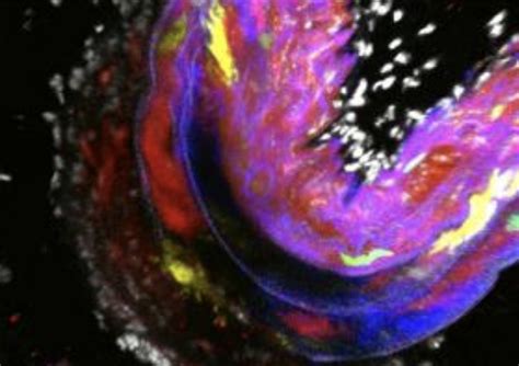 Primed Smooth Muscle Cells Act As First Responders” In Vascular Disease