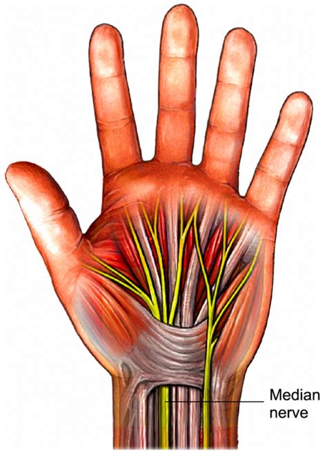 Median Nerve Carpal Tunnel