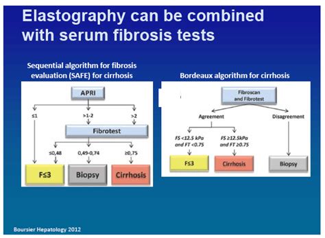 Iqr Fibroscan