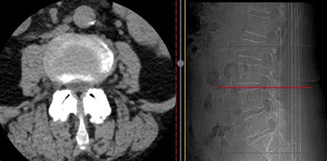 Computertomografie Ct Schnittbilder Des Körpers Röntgenuntersuchung Gießen Hessen