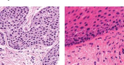 Figure 2 From A Robust Method For Nuclei Segmentation Of Hande Stained Histopathology Images