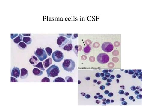 Cerebrospinal Fluid Csf Examination Under Microscope Pptx