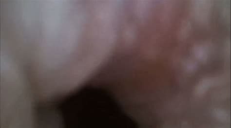 Colonoscopies ThisVid Com