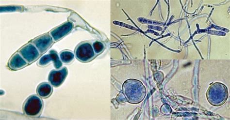 Epidermophyton Floccosum An Overview
