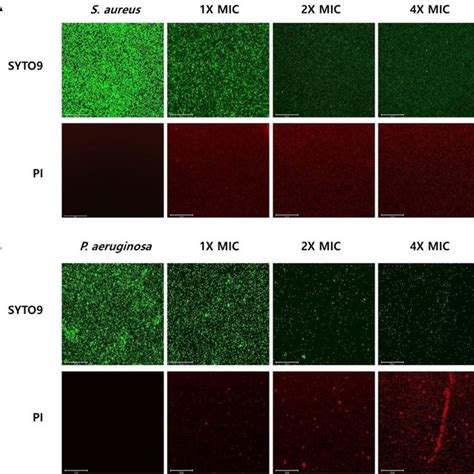 Models For Pore Formation By Amps A Barrel Stave B Wedge C Download Scientific Diagram