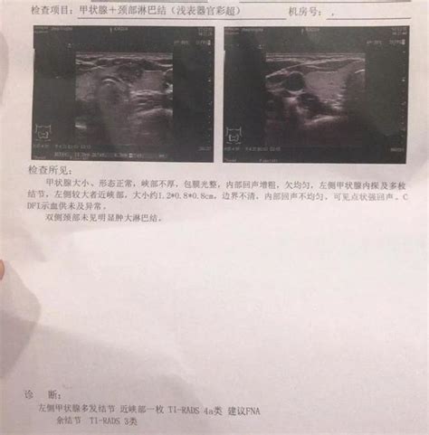 體檢查出癌症！31歲女白領：我是工作狂，天天宵夜減壓，以後不要太拼了 每日頭條