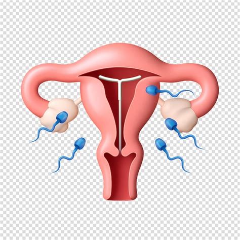 Intrauterine Device Iud For Contraception Within The Female