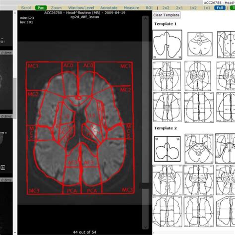 Template Masking Tool On The Right Part Of The Window A Library Of Download Scientific