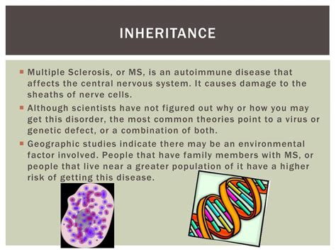 Ppt Multiple Sclerosis Powerpoint Presentation Free Download Id