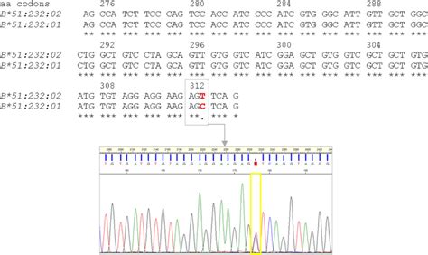 Sequence Alignment Of The Hla‐b Exon 5 Between The Novel Download