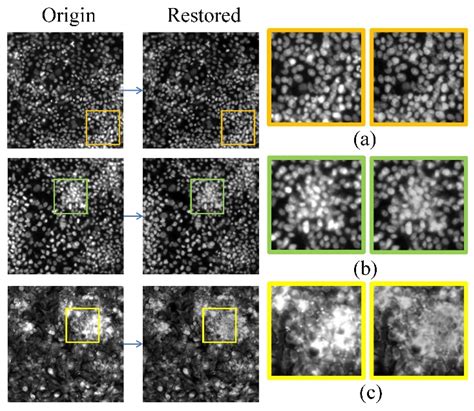 A Saturation Artifacts Inpainting Method Based On Two Stage Gan For