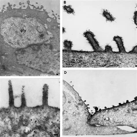 Transmission Electron Microscopy Of Epithelial Cells Cultured On A Download Scientific Diagram