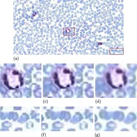 A Super Resolution Result Of Applying The Dataset 2 Trained Deep Cnns