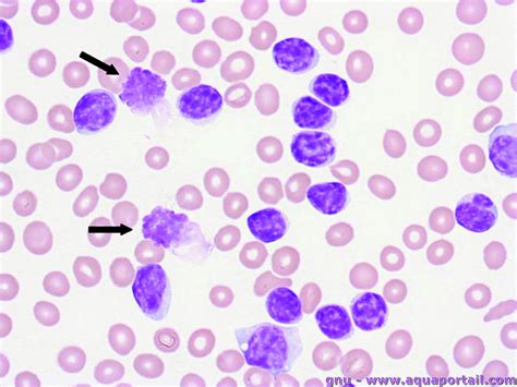 Lymphocytes Definition