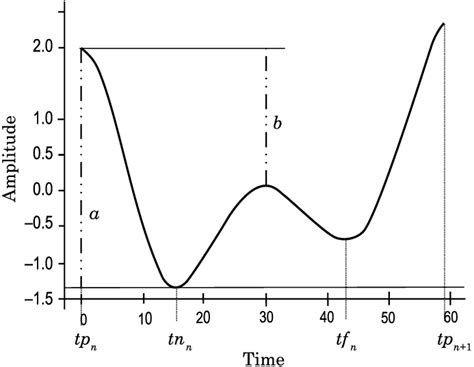 Morphological Characteristics Of The Photoplethysmographic Signal Download Scientific Diagram