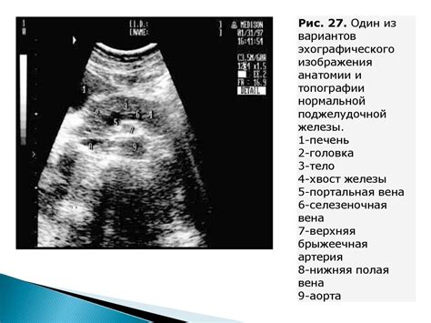 Ультразвуковое исследование органов брюшной полости презентация онлайн
