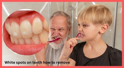 White Spots On Teeth How To Remove And More