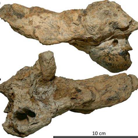 The Periotic Mumab 240508 A Lateral View B Medial View Download