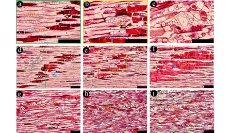 Safranin O Staining Of Tangential Sections Of The Process Of Tissue